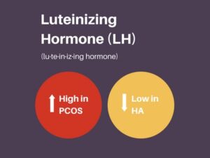 Is It PCOS or Hypothalamic Amenorrhea (Undereating)?